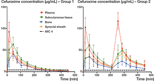 Local cefuroxime tissue concentrations in the hand after single and ...
